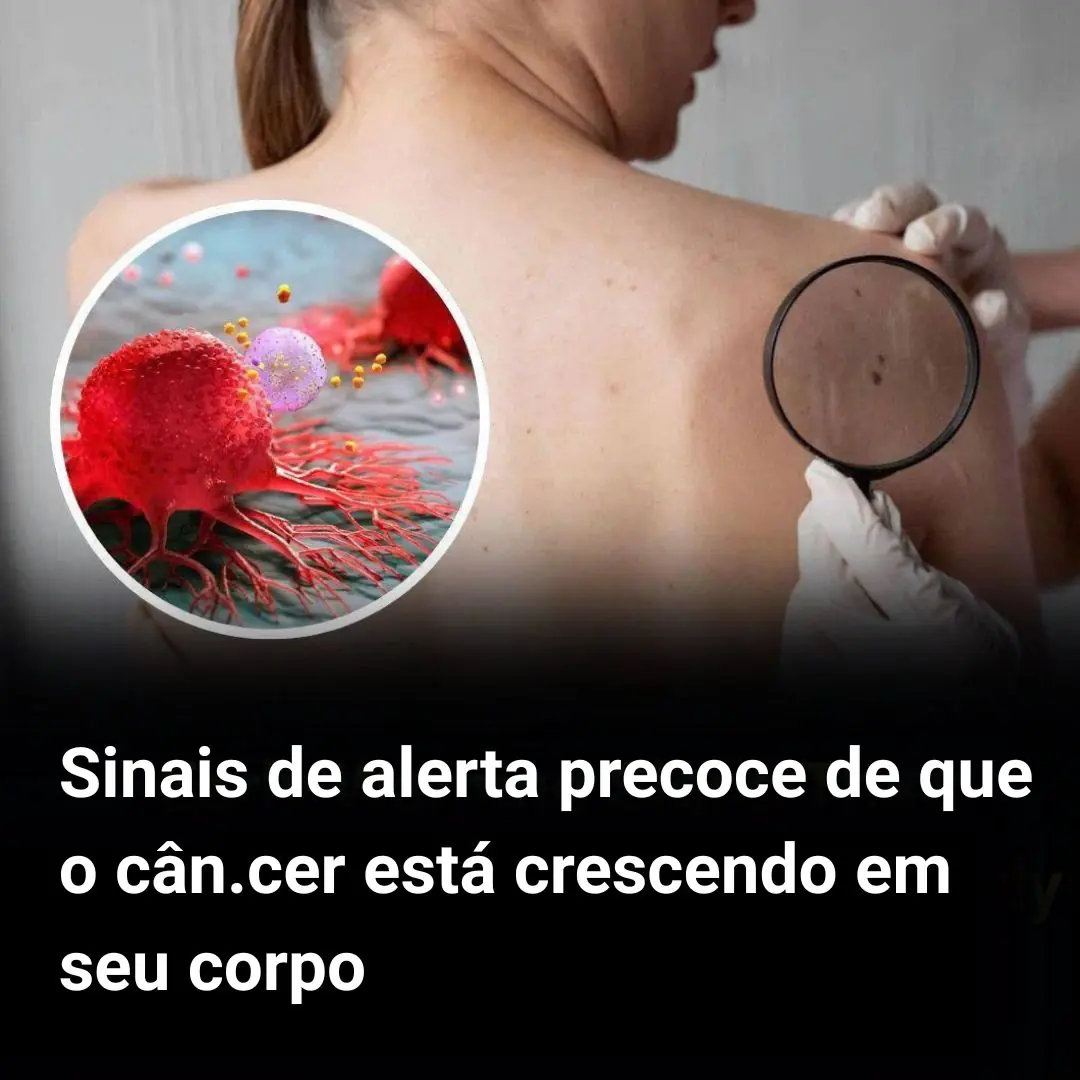 Sinais de alerta precoce de que o cân.cer está crescendo em seu corpo