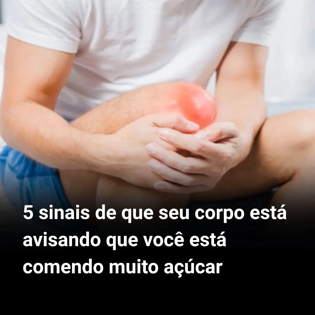 5 sinais de que seu corpo está avisando que você está comendo muito açúcar