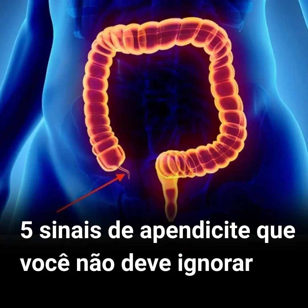5 sinais de apendicite que você não deve ignorar